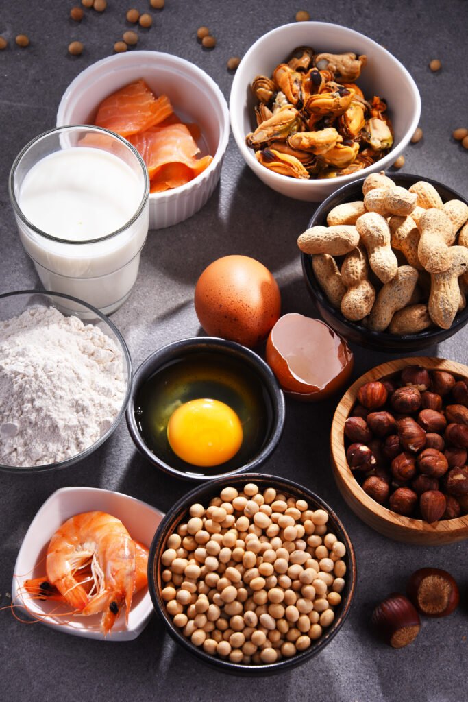 Food Sensitivity - Touchpoint Integrative Wellness Center